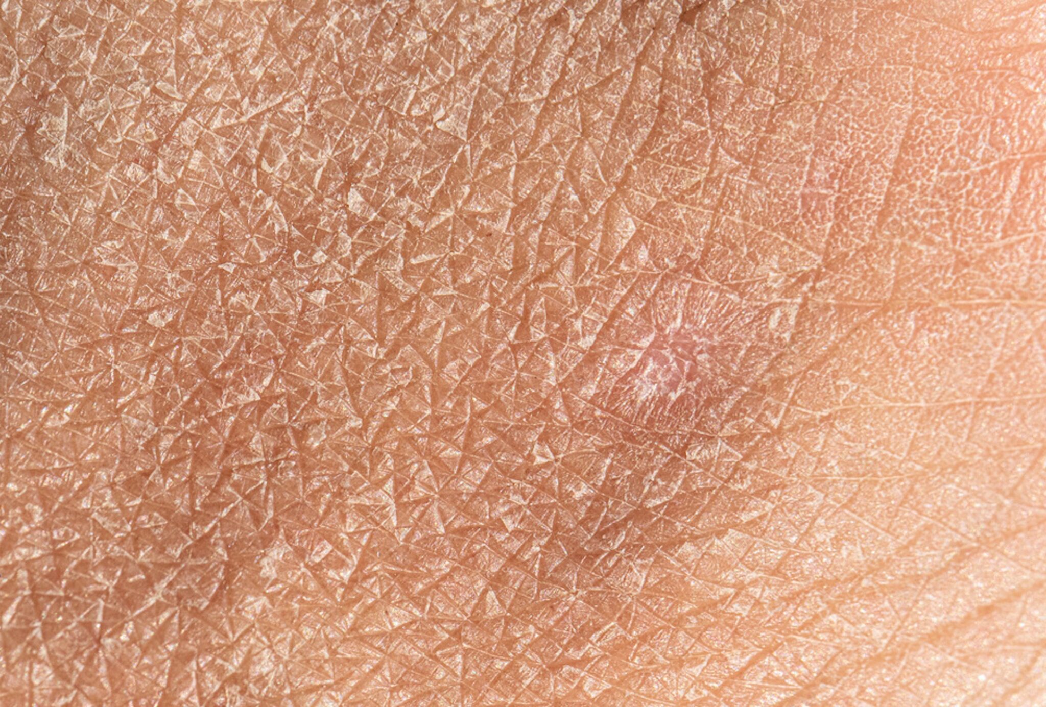 How to prevent dry skin in winter? | DU'IT | Australian Skincare